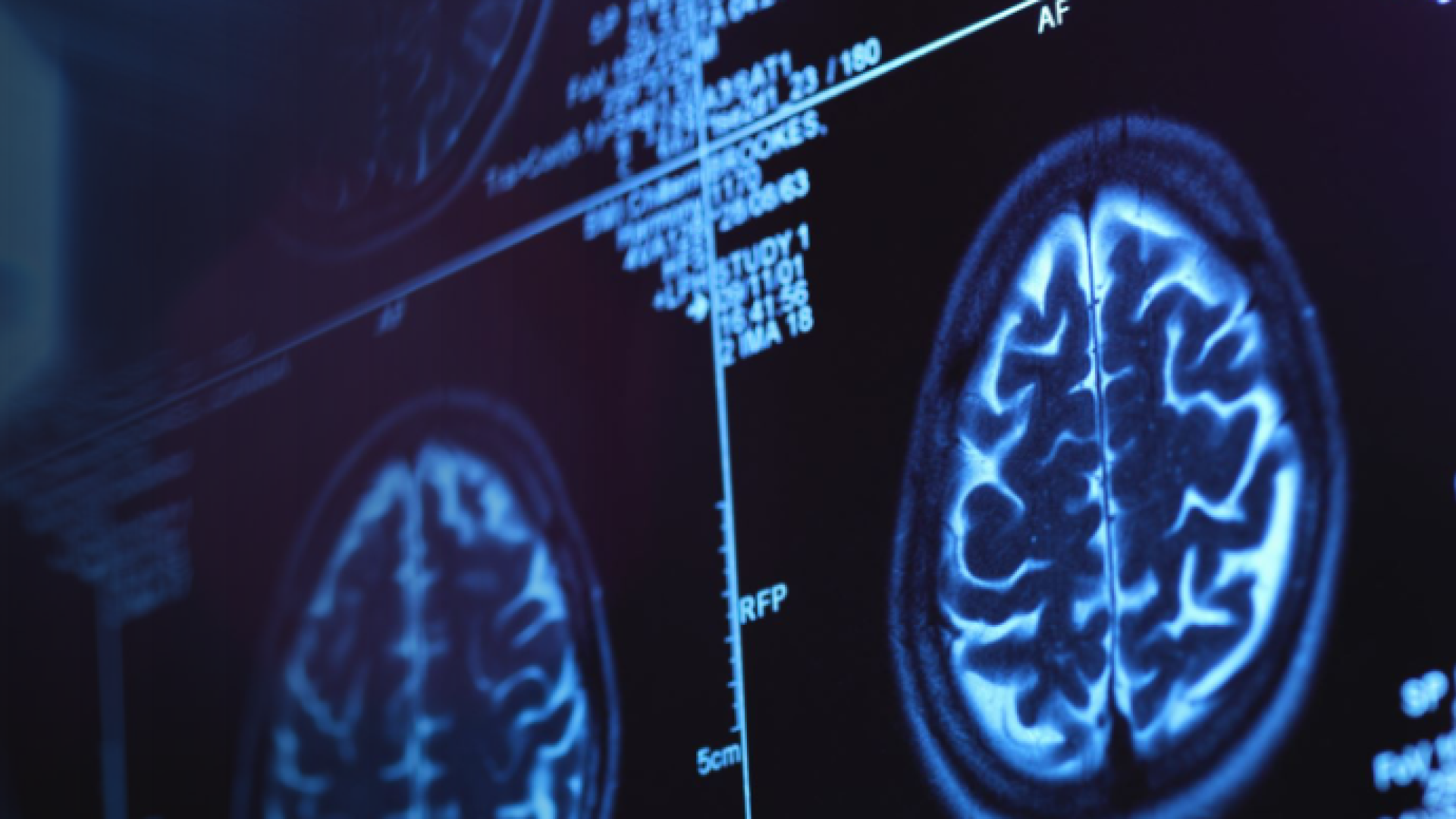 Breaking Barriers in Imaging: Groundbreaking Hackathon Enhances ...