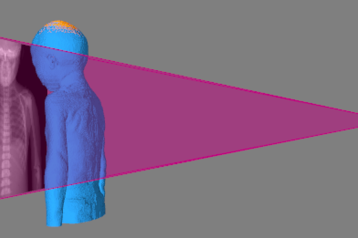 Breaking Barriers in Imaging: Groundbreaking Hackathon Enhances ...